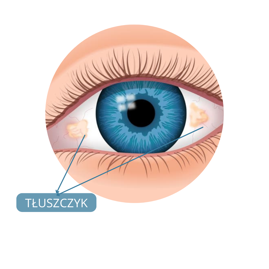 TŁUSZCZYK - 4 Eyes Optyka